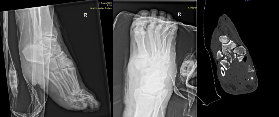 Gruenberger_Figure 2 – SEMS-journal